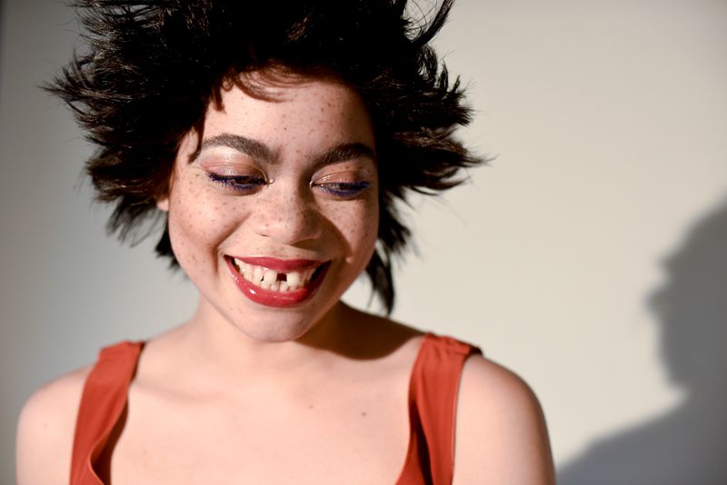 Dancing With Myself for Desphosphenes (Various Editorials)