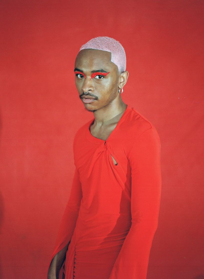 Psoriasis Portraits: 8 People Share How They've Embraced Their Skin ...
