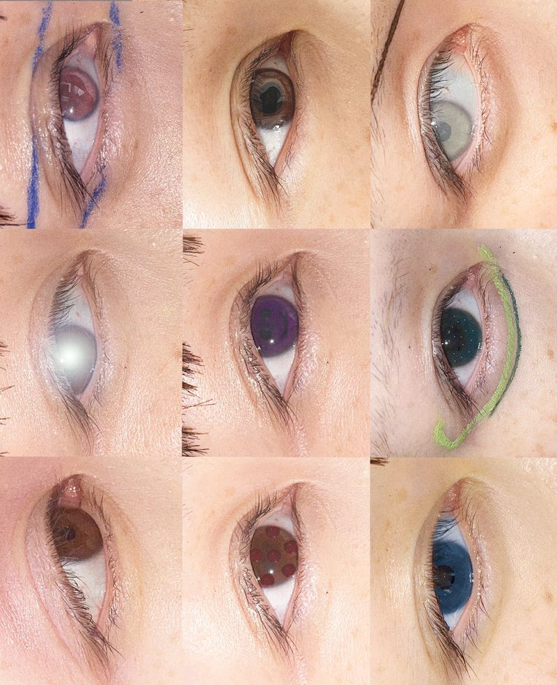 One vs Many (Various Editorials)