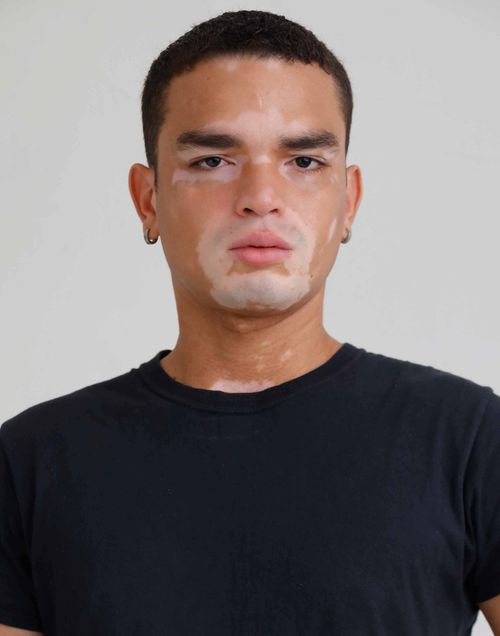 Daniel Ruenes - Model Profile - Photos & latest news