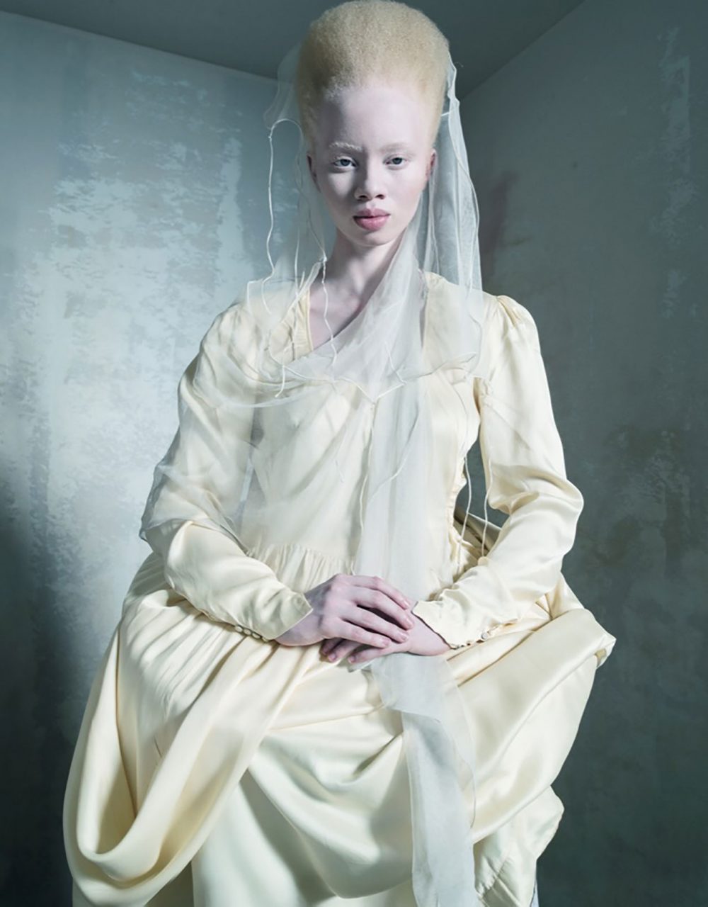 Meet the Model Fighting Misconceptions About Albinism – Of The Minute